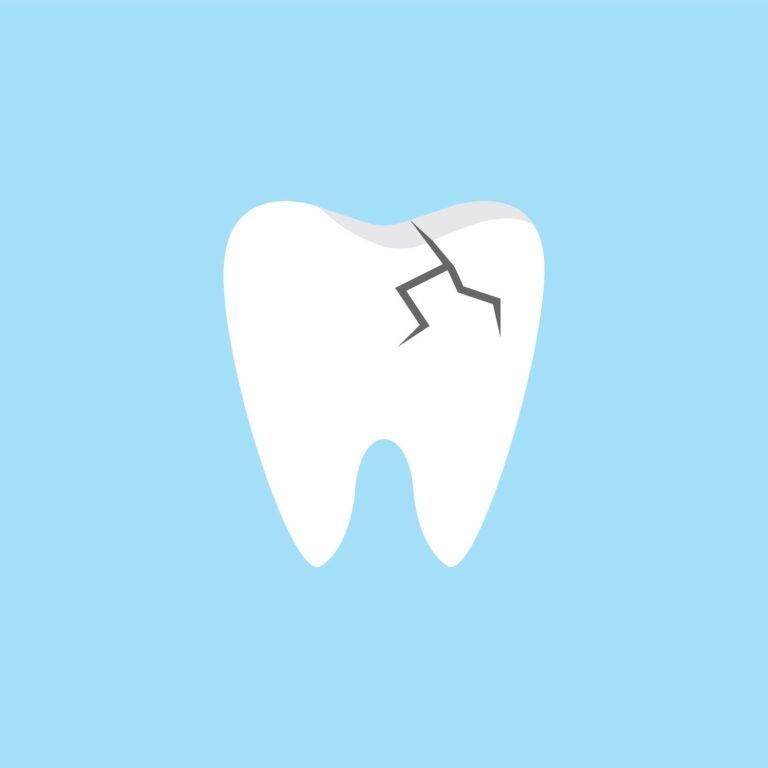 Do I Have a Tooth Fracture? - Restorative Dentist in Asheville, NC